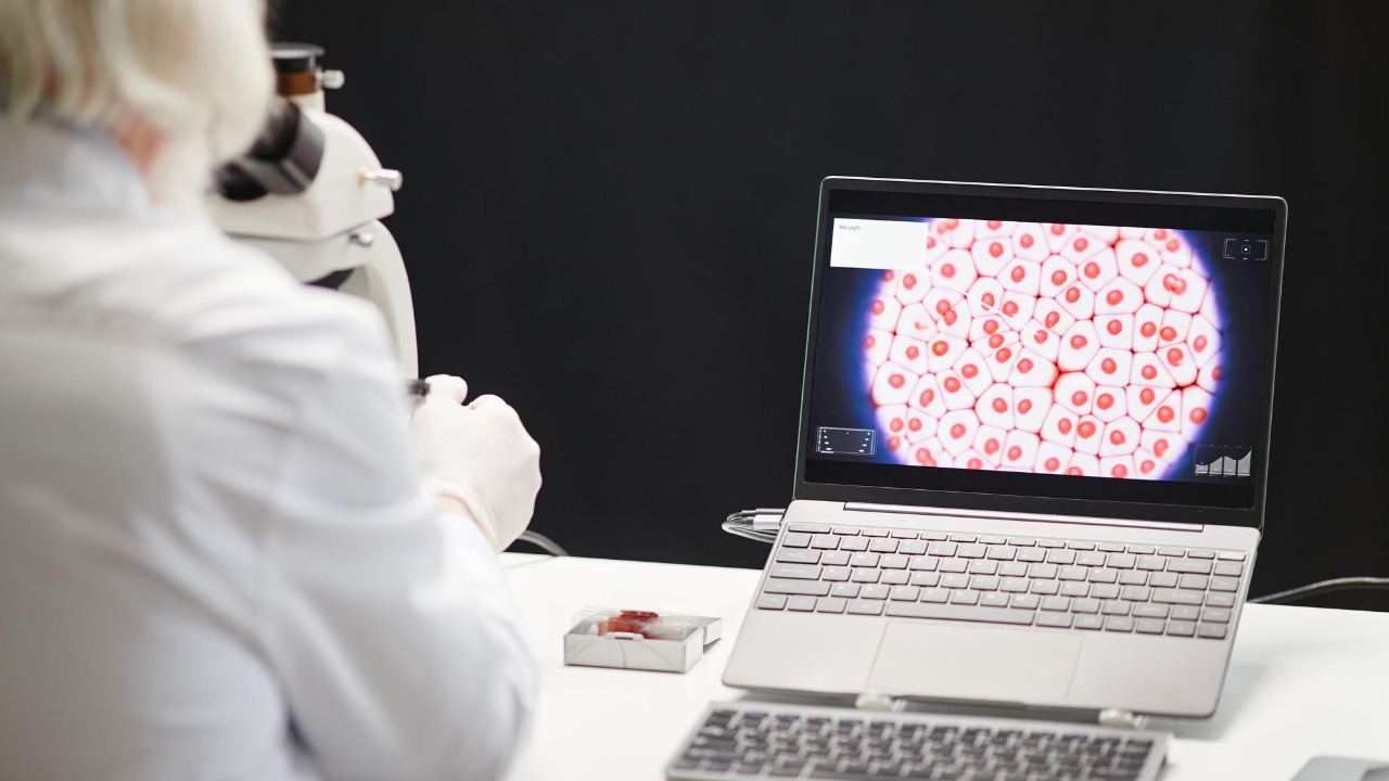 A new bispecific antibody beat standard immunotherapy against squamous ...