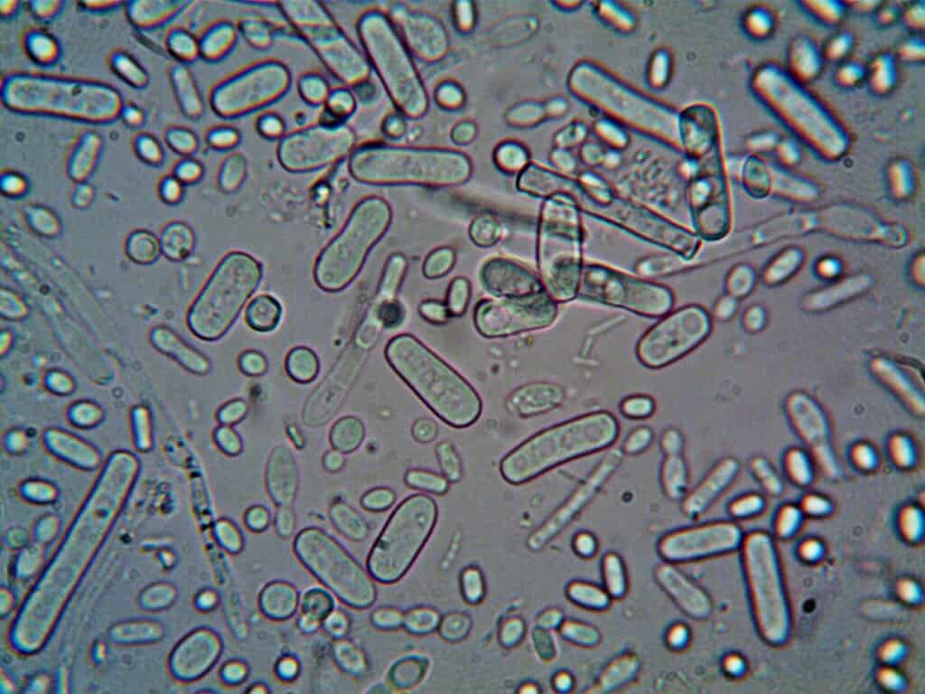 Scientists found that bacteria can remember stress even though they ...