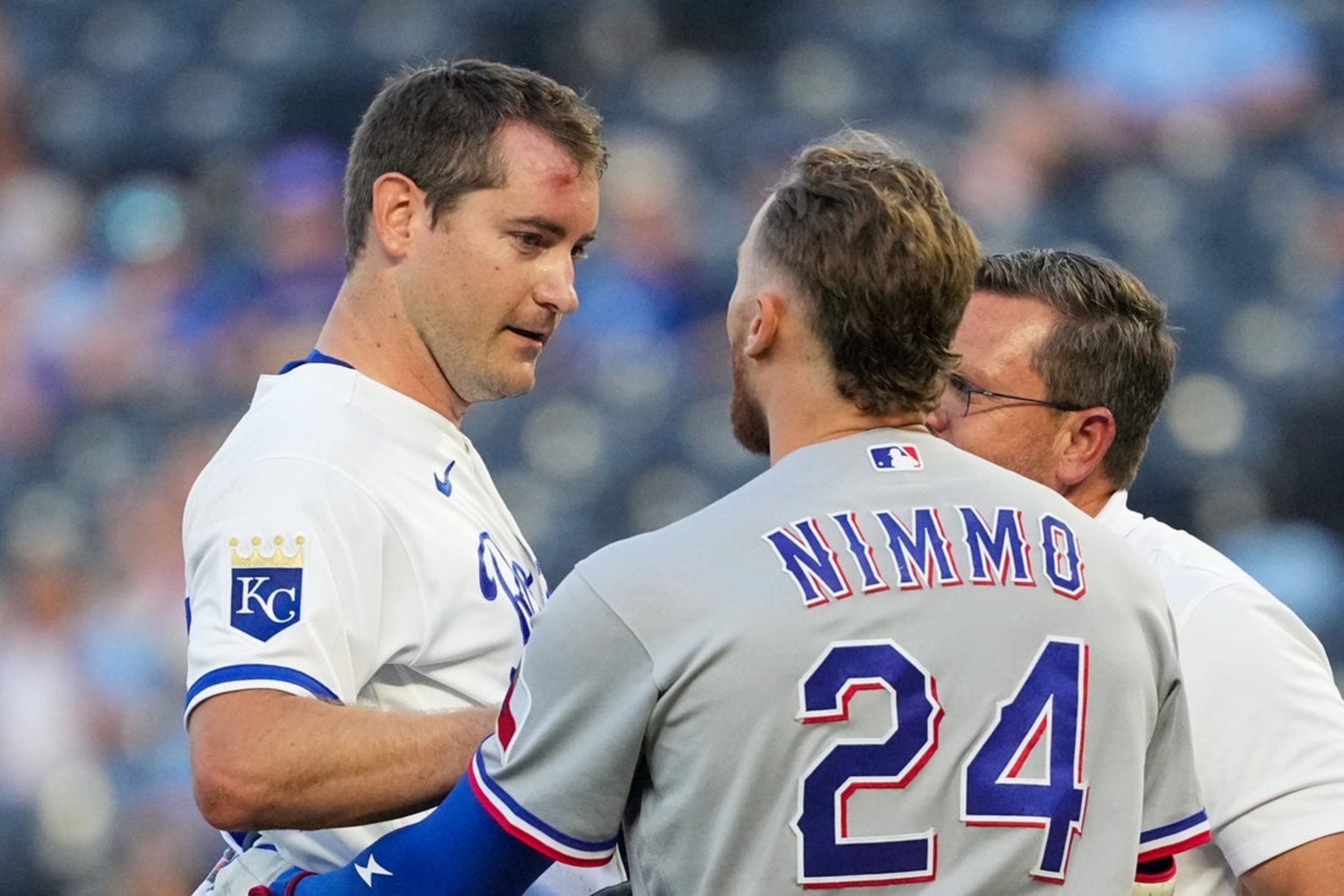 Royals RHP Seth Lugo takes liner off forehead, exits game vs. Rangers