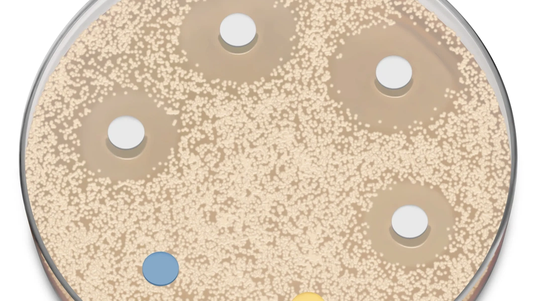 Why microbes might just save our planet
