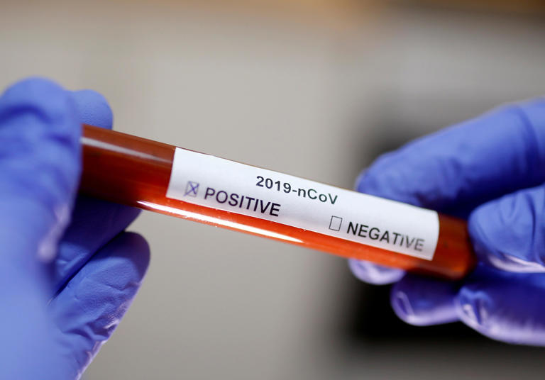 AI-developed vaccine found safe in early human trial results - Cambridge