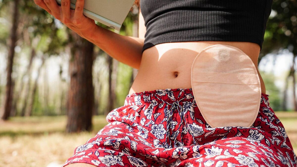 Pilot scheme for colostomy bag users to be introduced in Cobh public ...