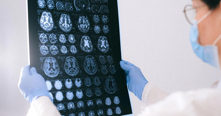 Three common sleep habits linked to faster brain aging