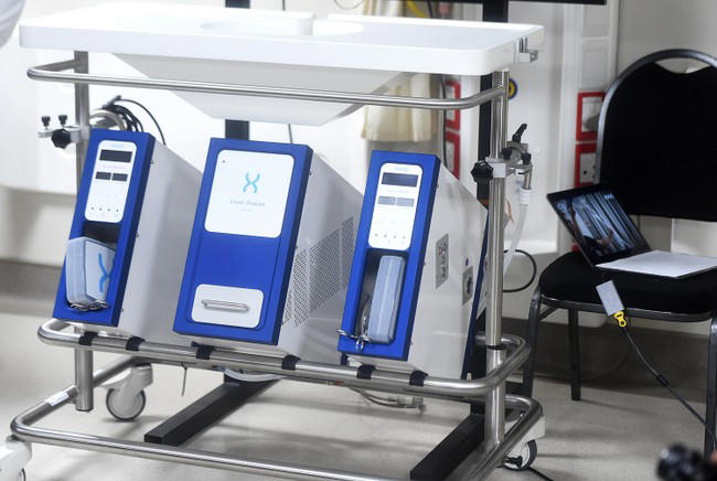 Breakthrough in transplant care: Transformative potential of the new ...