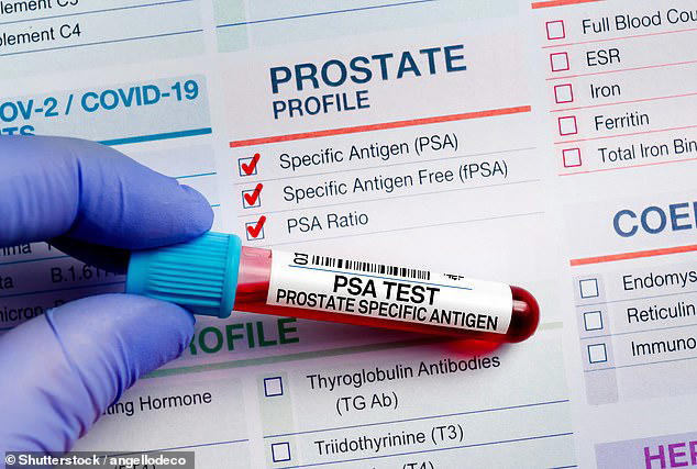 Experts back new form of prostate cancer screening - opening the door ...