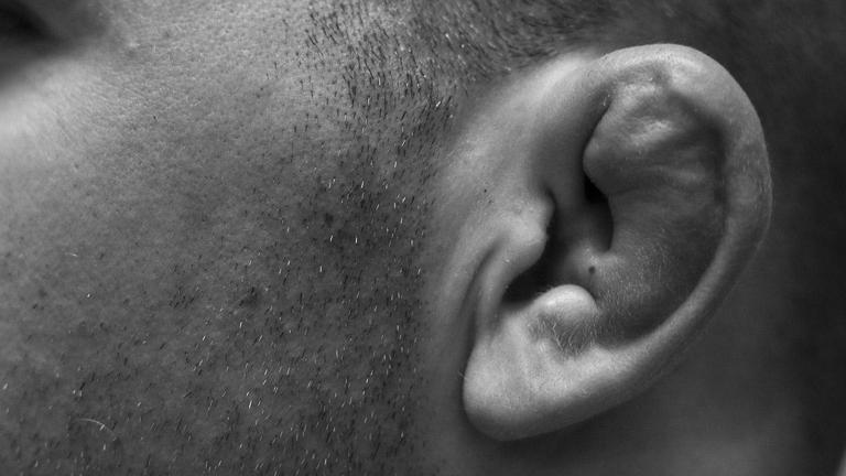 UFC star Bo Nickal says he always wanted cauliflower ear because 'the ...