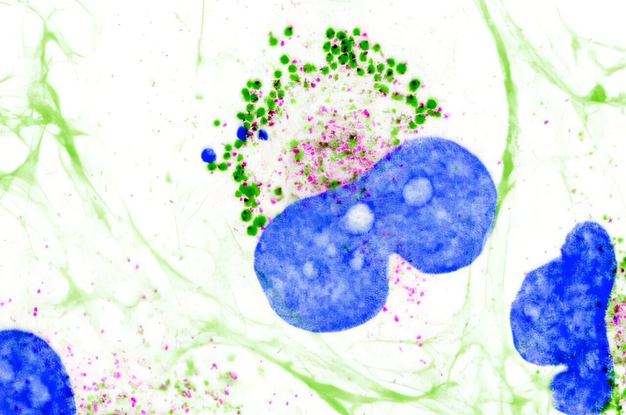 Scientists discover collagen, the human body's most abundant protein ...