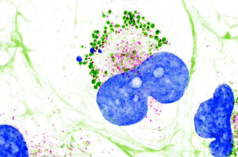 Scientists discover collagen, the human body's most abundant protein ...