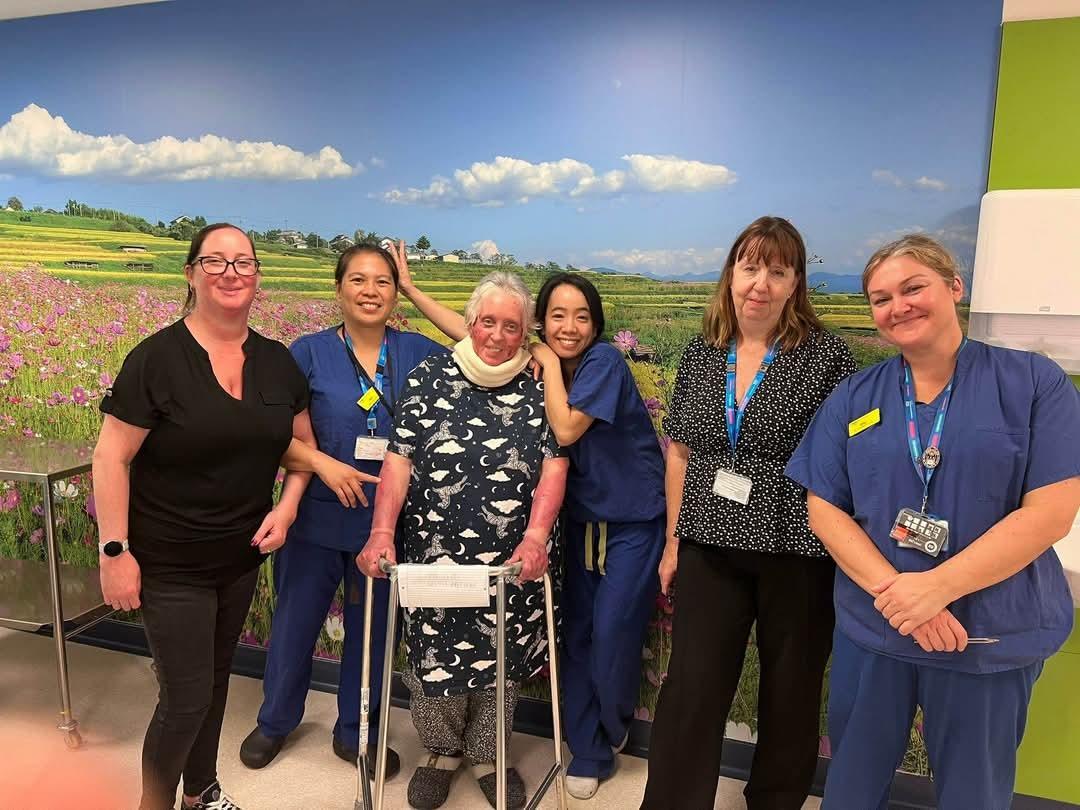 Third degree burns survivor launches Hemel Hempstead charity match ...
