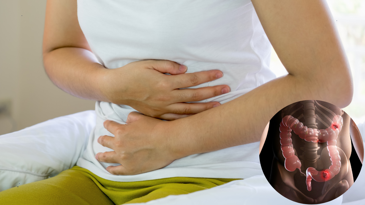 Scientists finally have answers to what causes inflammatory bowel disease