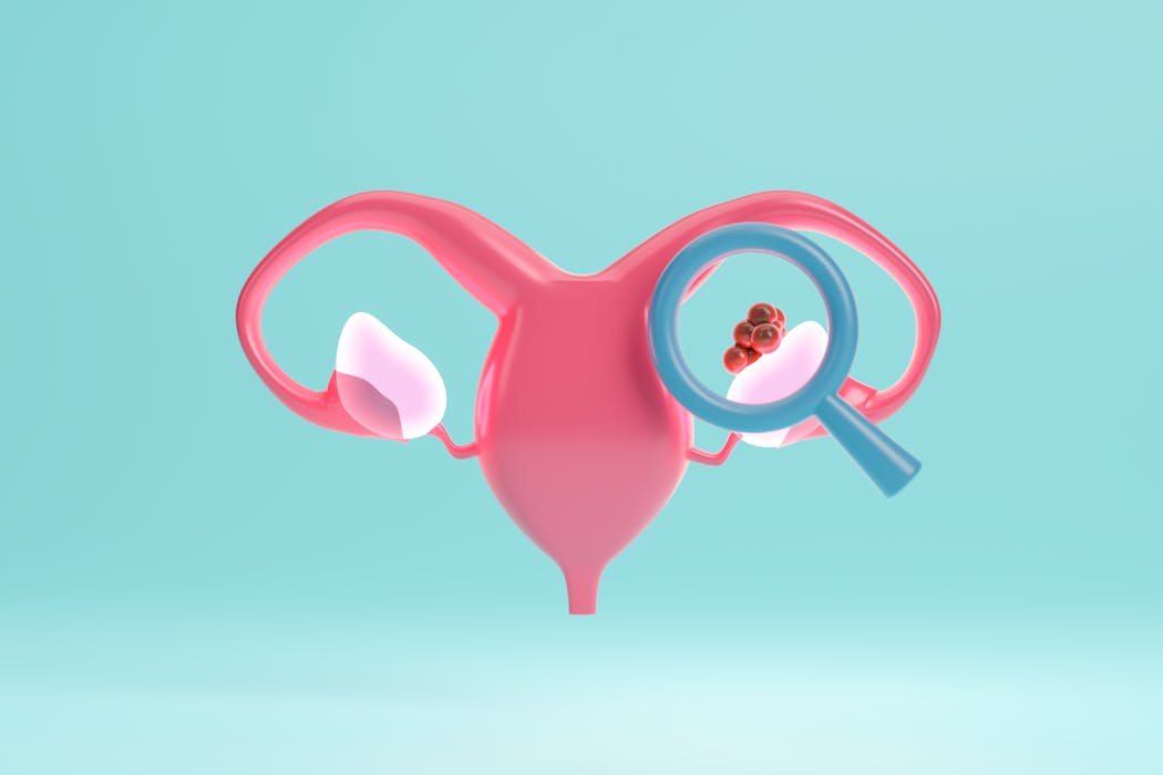 Ovarian cancer drug approved for NHS use will prolong lives