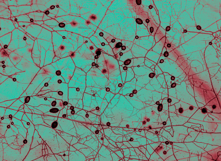 First global map of mycorrhizal fungi reveals true scale of underground ...