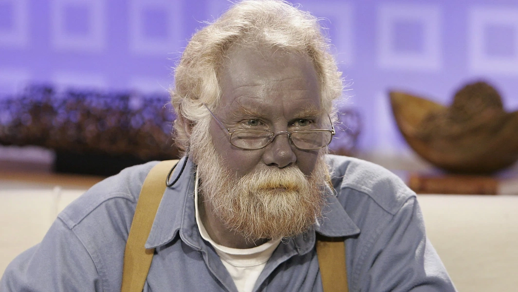 Paul Karason and the risks of colloidal silver