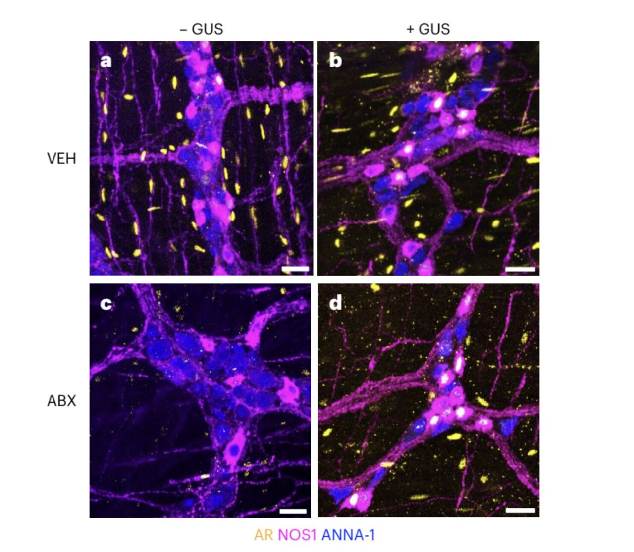 Gut microbes unlock hormone signaling that regulates gut movement ...