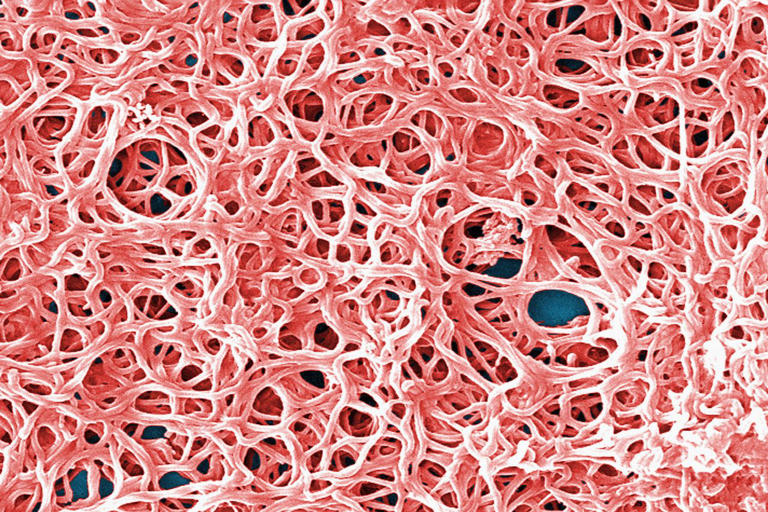 Rare Lyme disease-causing bacteria detected in New York ticks for the ...