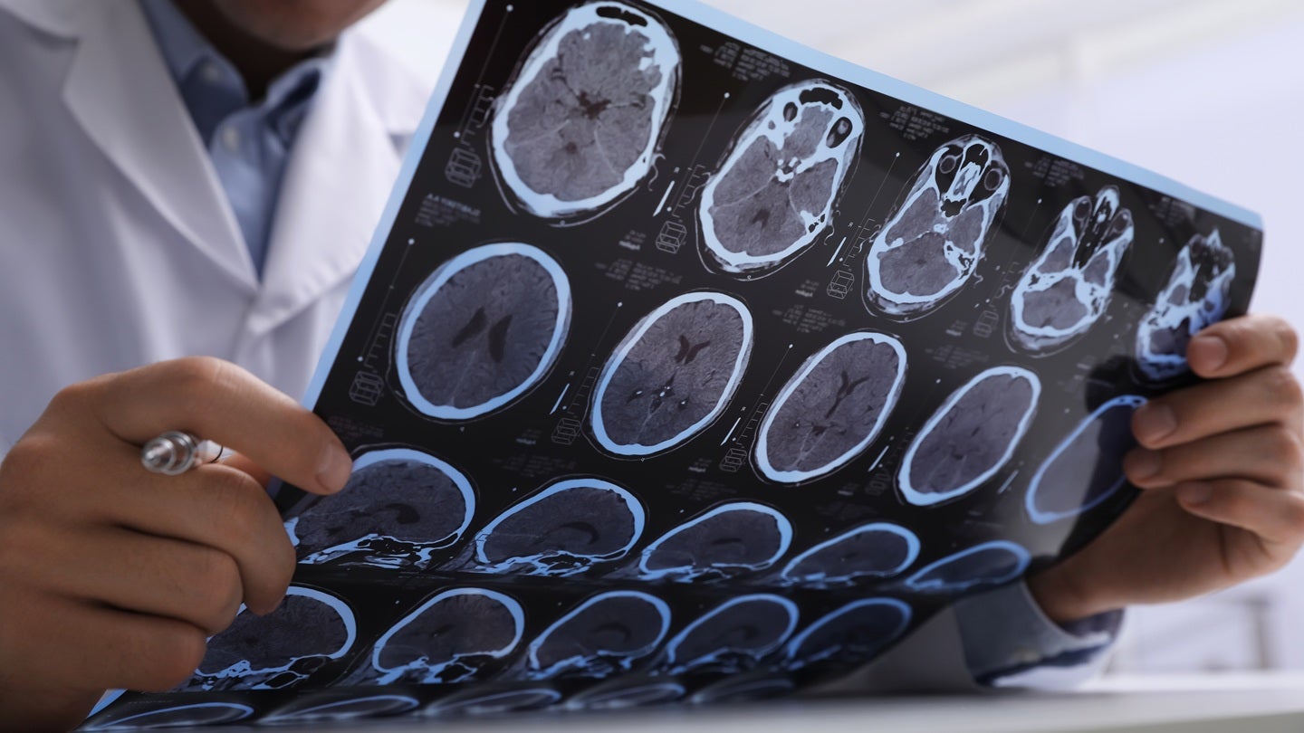 CONNECTA Therapeutics begins phase IIa trial of CTH120 for FXS
