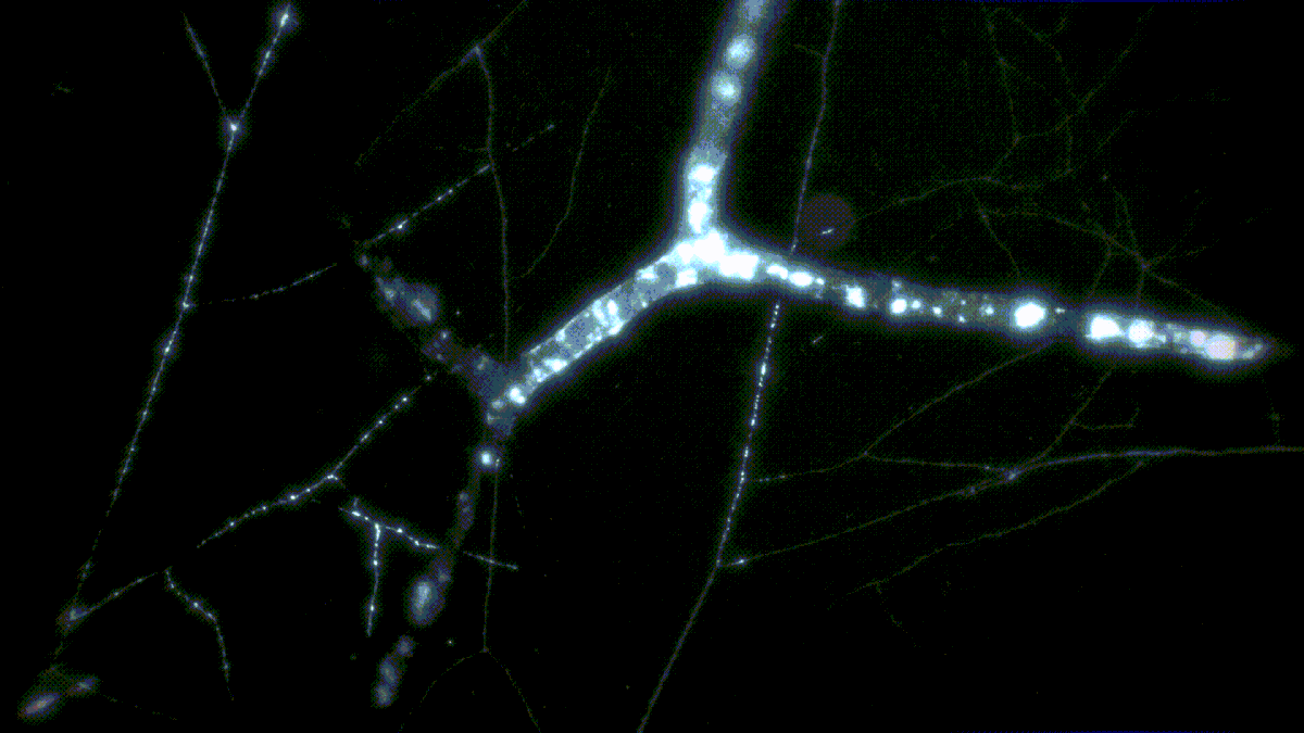Hidden web of fungus inside Earth could reach the sun a billion times