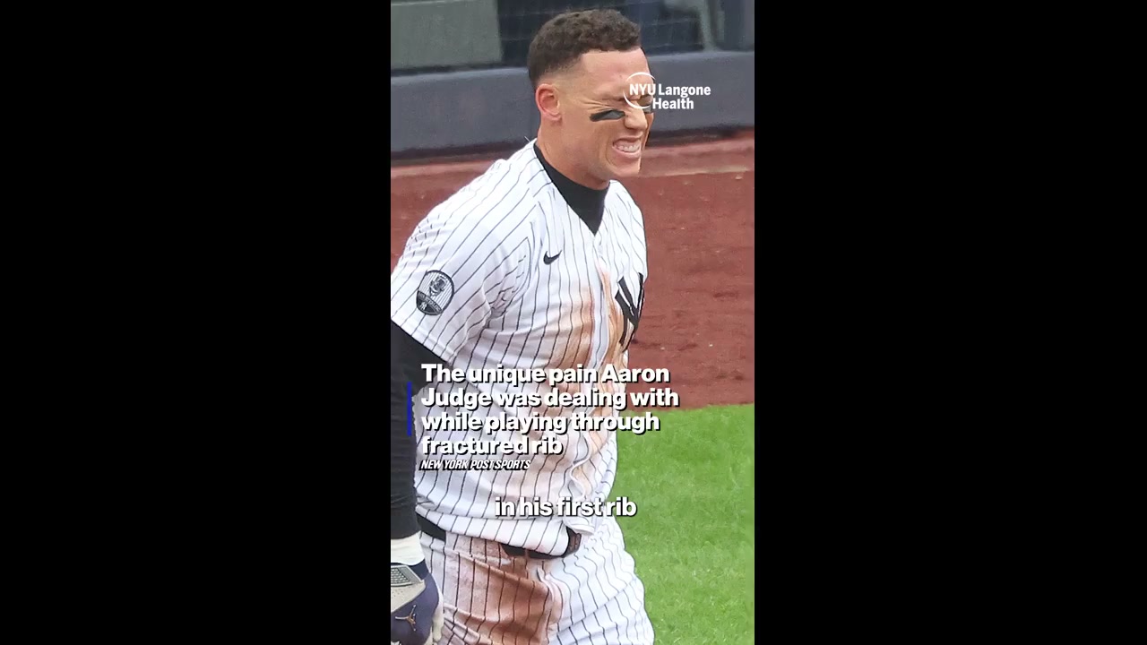 What really caused Aaron Judge's rib fracture?