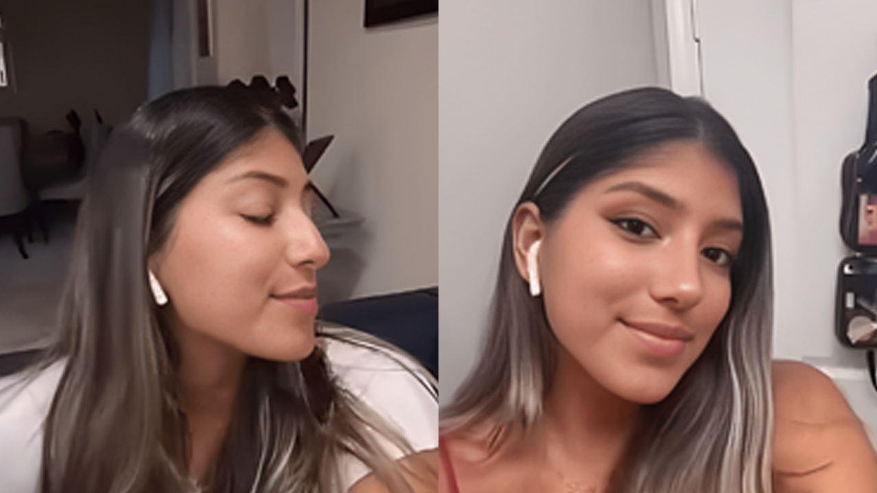 Plastic surgeon reacts to a rhinoplasty transformation journey