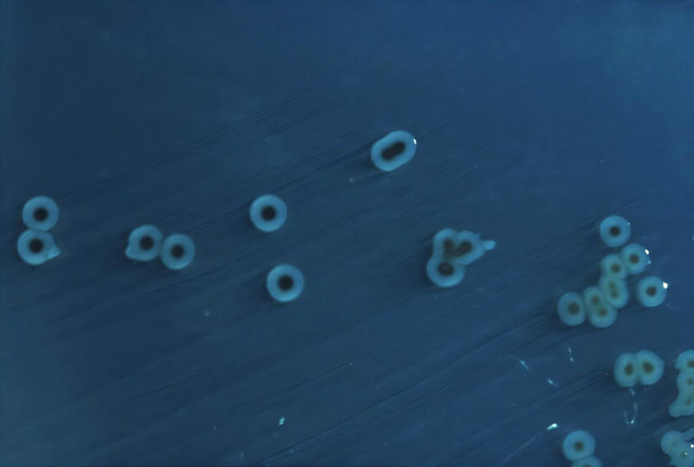 Salmonella genomes reveal 45 previously unknown toxins in foodborne ...