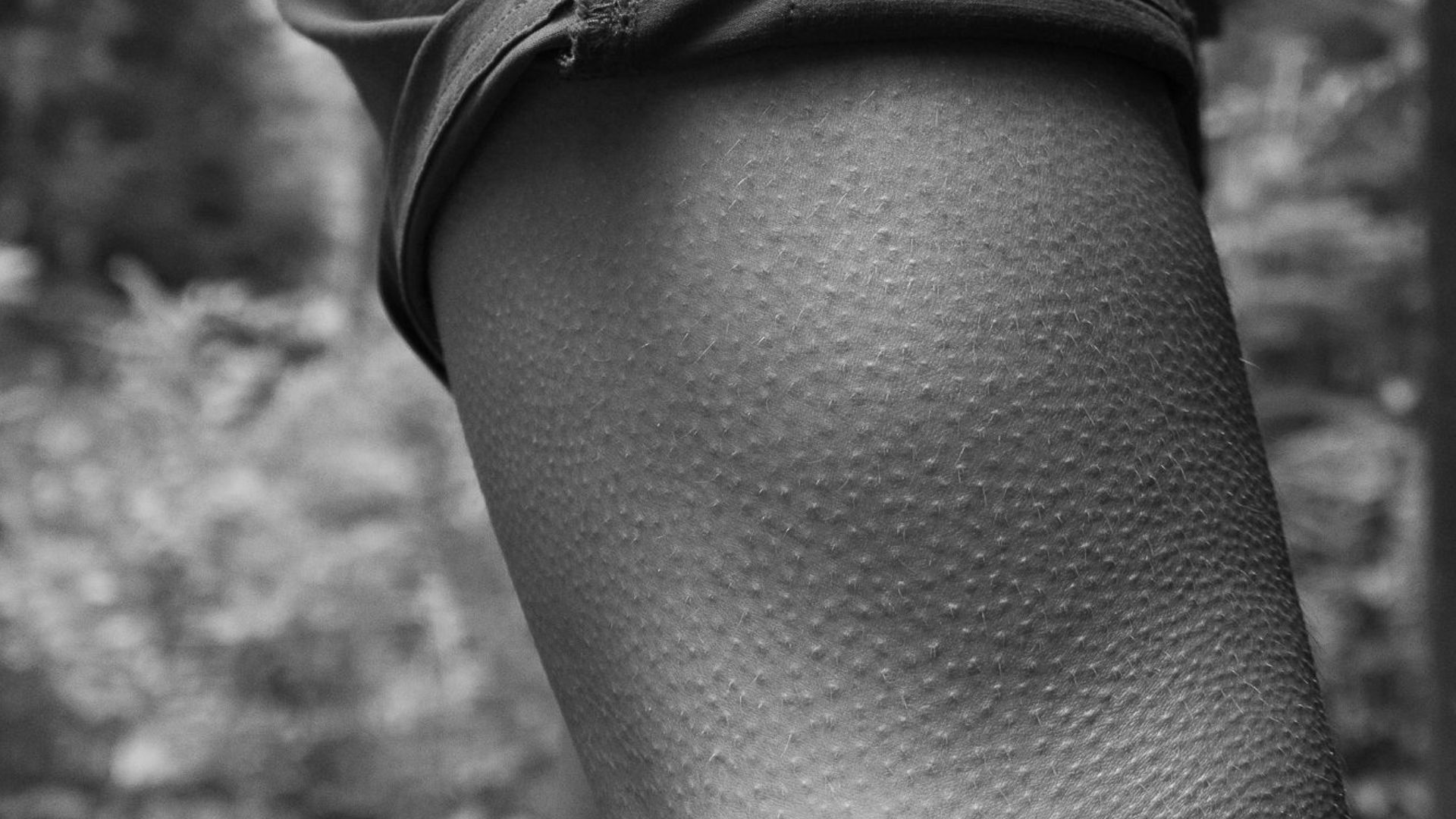 20 strange things your skin does to protect you
