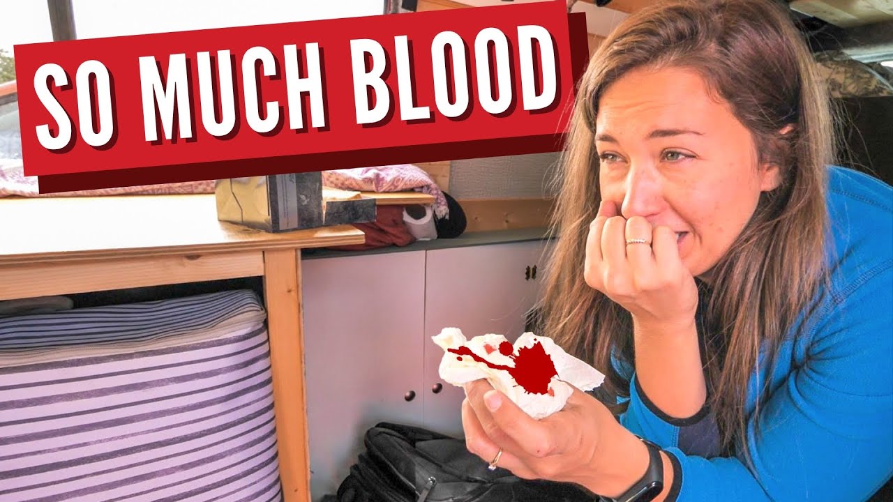 My unexpected hospital visit on the NC500