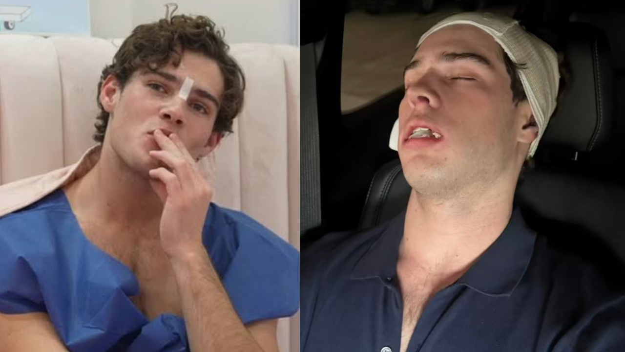 How many surgeries has streamer Clavicular completed ahead of Paris ...