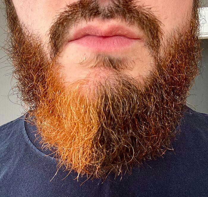 People share 44 rare and unusual physical traits in photos