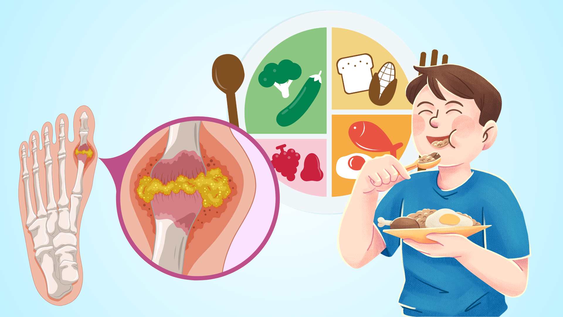 Thực phẩm nên ăn cho người bệnh gout trong mùa nắng nóng