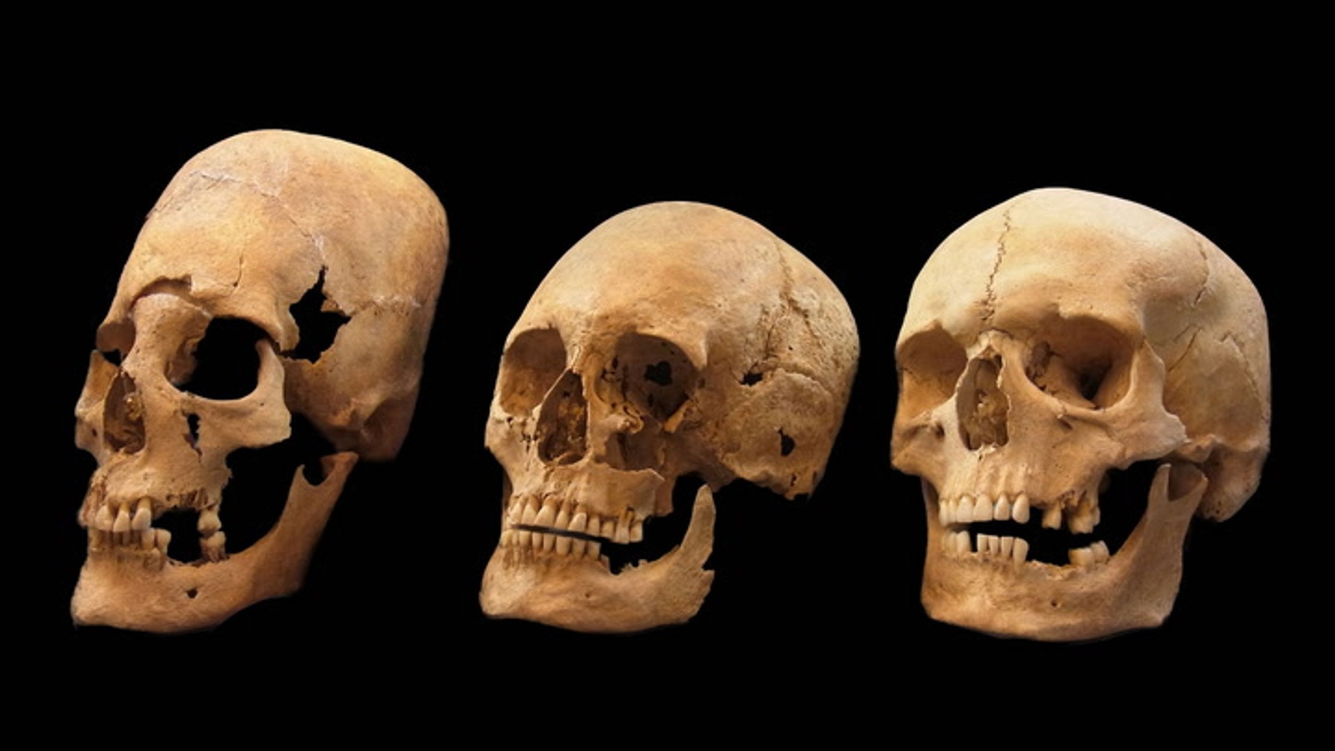 Foreign eggheads: Pointy-skulled women were immigrant brides