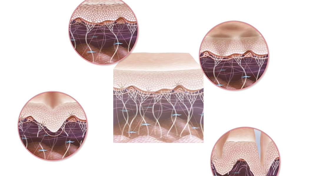 Dermatologists stress sunscreen and key actives for summer skin health