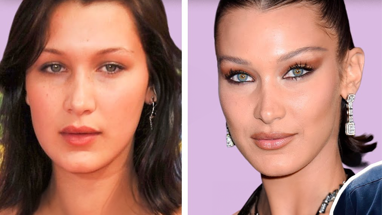 Doctor explains Bella Hadid’s cosmetic surgery transformation