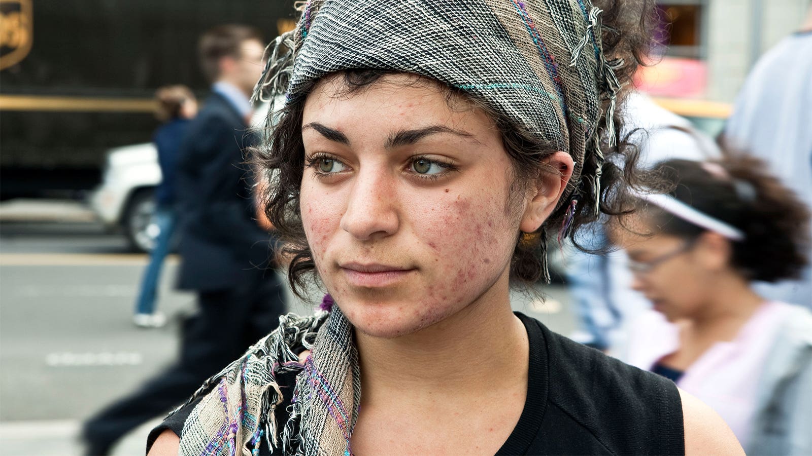 Is microdosing Accutane safe? Dermatologist weighs in
