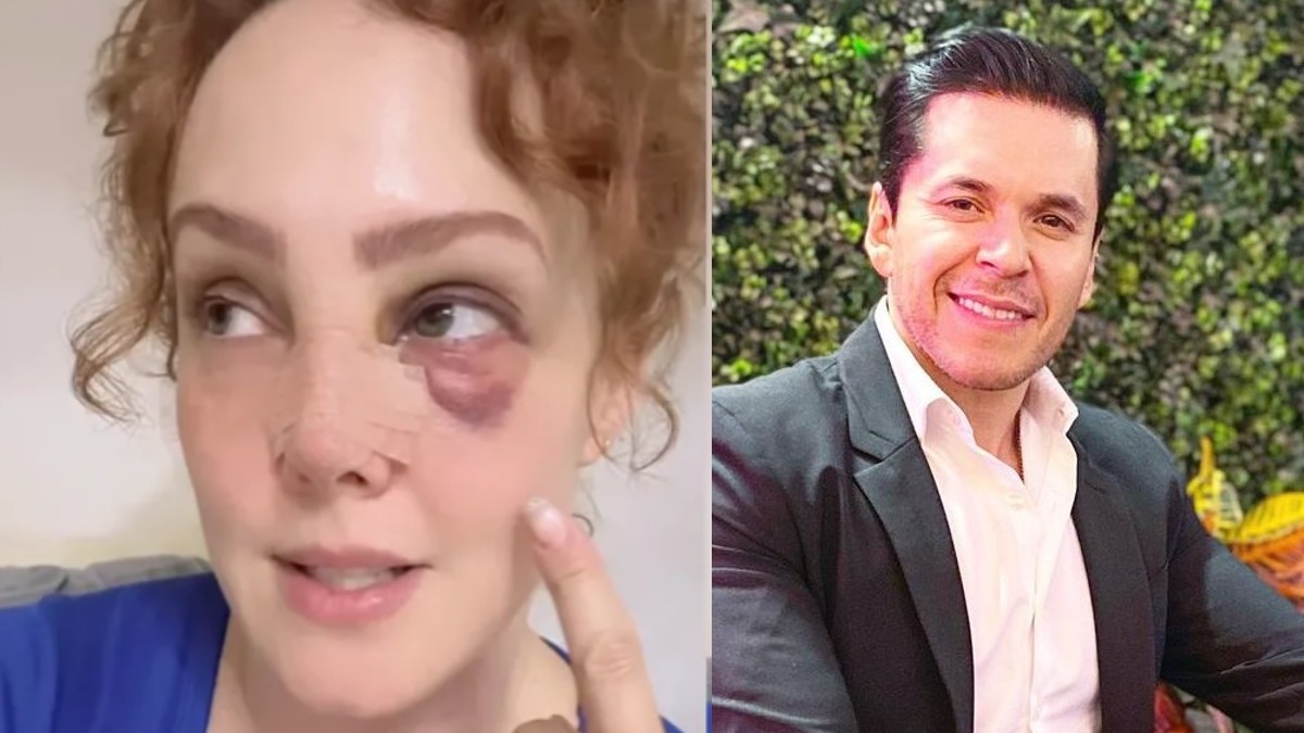 Fran Meric aparece golpeada en redes sociales y usuarios culpan a su ...