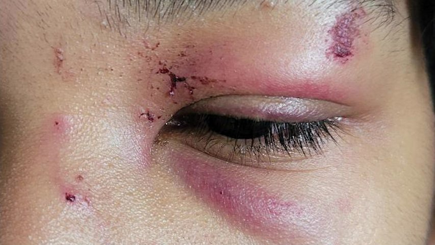 To see him bloody, his glasses broken, Bronx mom wants answers after ...