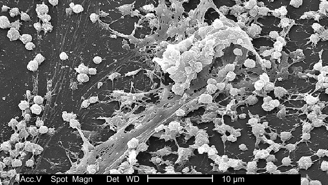 Biofilms and the secret life of bacteria
