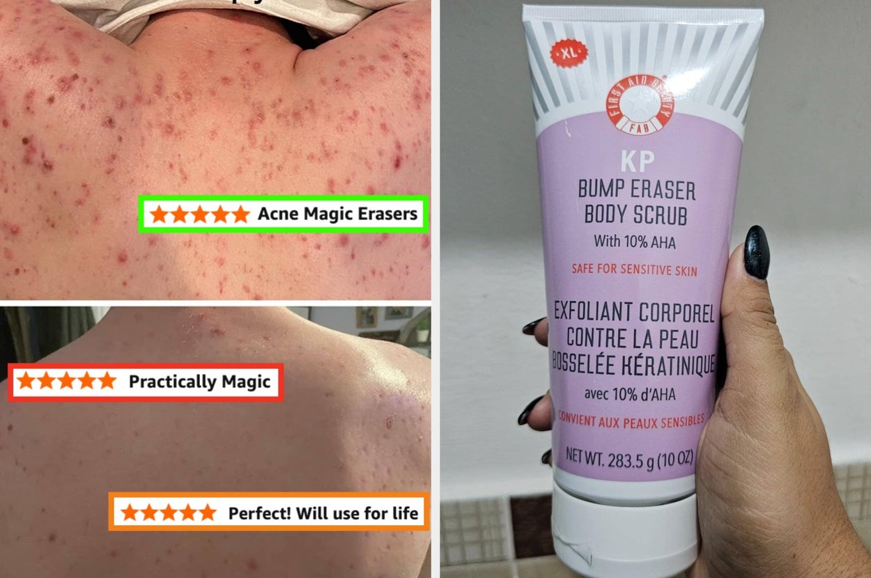 If you’ve hit the body acne part of your skincare journey, try these 27 ...