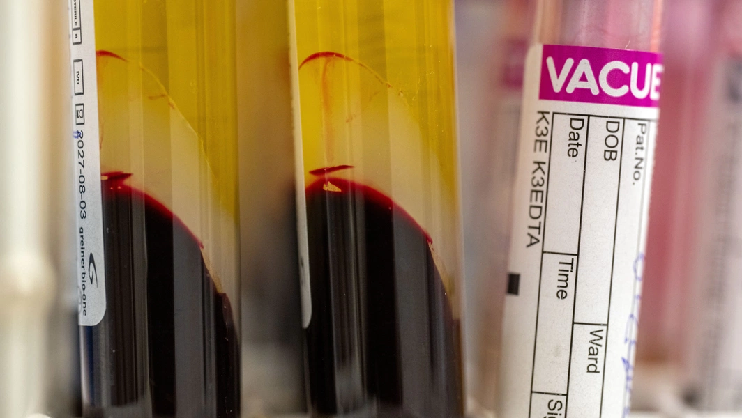 Understanding and discussing blood test results