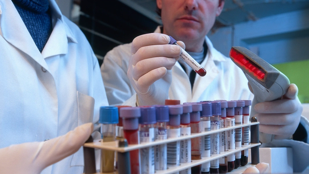 Cancerguard multi-cancer blood test overview