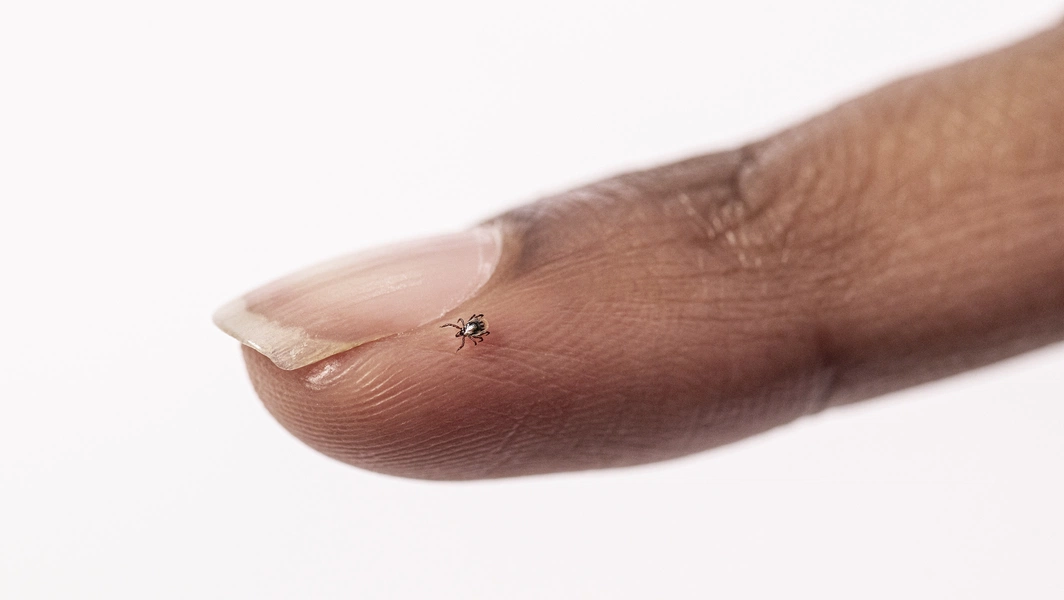 Recognizing and preventing Lyme disease from tick bites