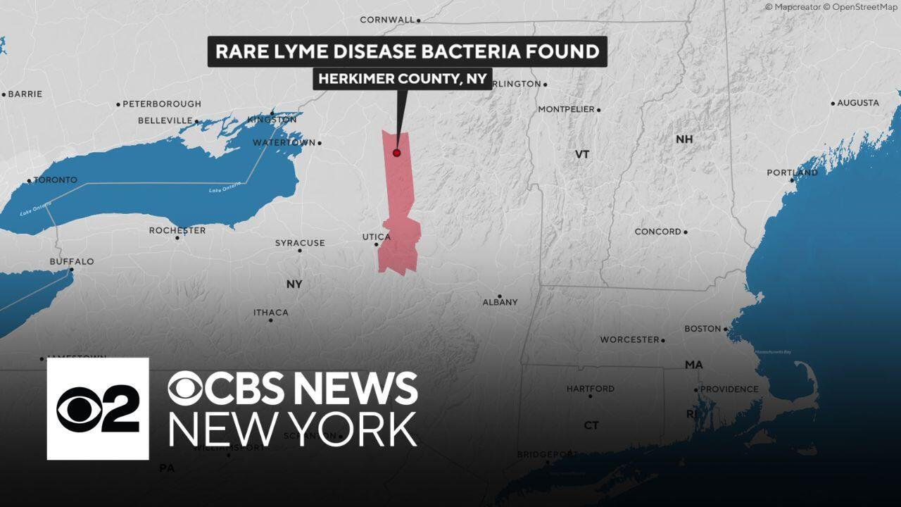Rare Lyme disease bacteria found in New York ticks