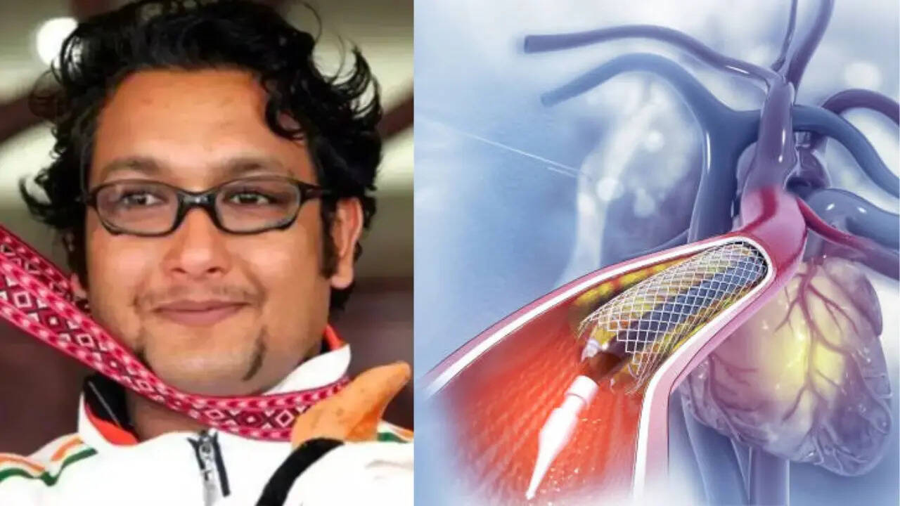Jaspal Rana death: Can a heart stent fail? What patients need to know