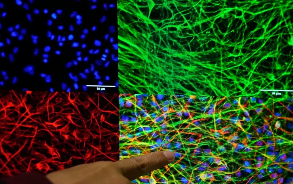 Inside the evolving science of the nervous system