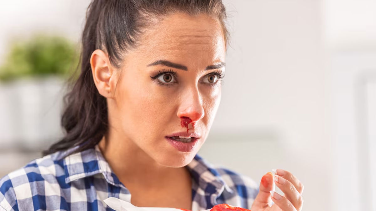 What vitamin deficiency causes nosebleeds? An ENT specialist explains