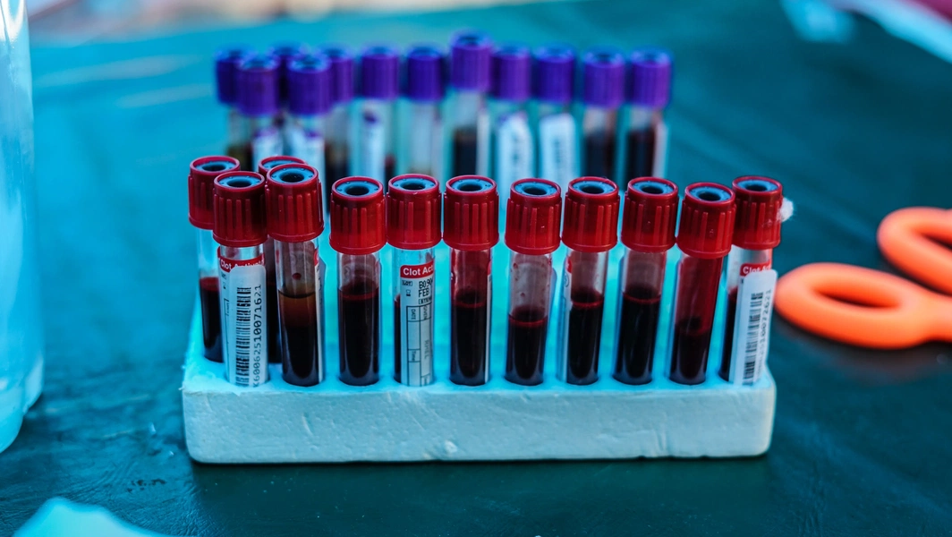 Understanding and discussing blood test results