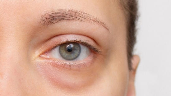 Hot weather makes your eyes look tired? Doctor shares tips to manage ...