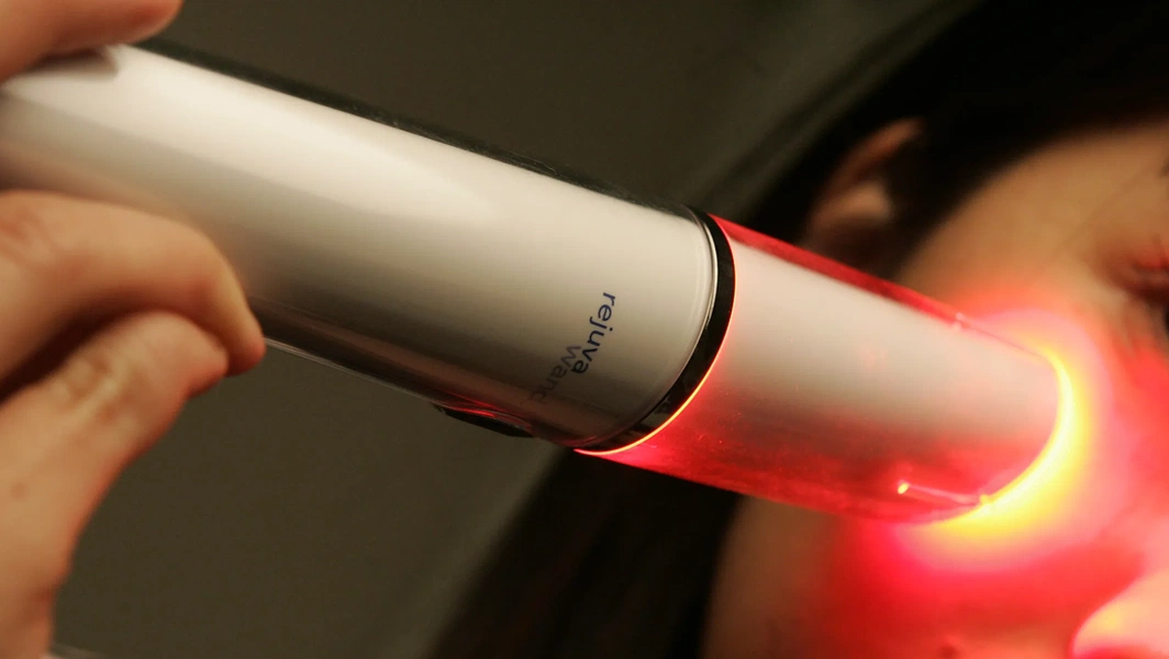 Experts say safe laser treatments now possible year-round