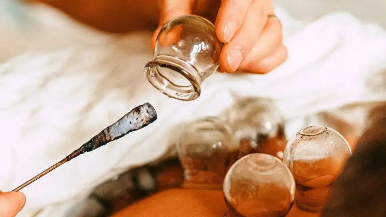 Wet cupping, wat is het en is het gevaarlijk?