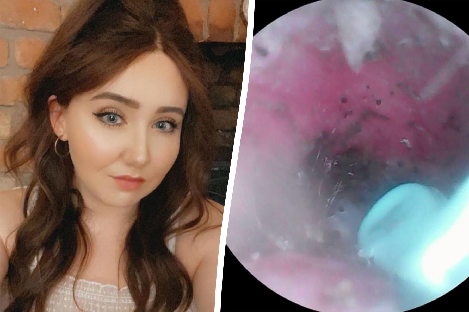 Mum used earbud camera to discover a spider's nest - inside her ear