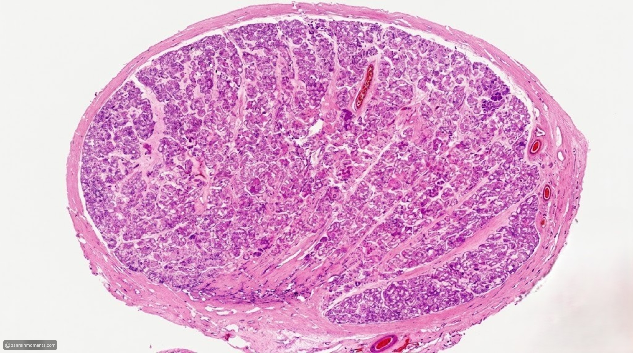 New 3D microscope technology produces high-resolution tissue images at ...